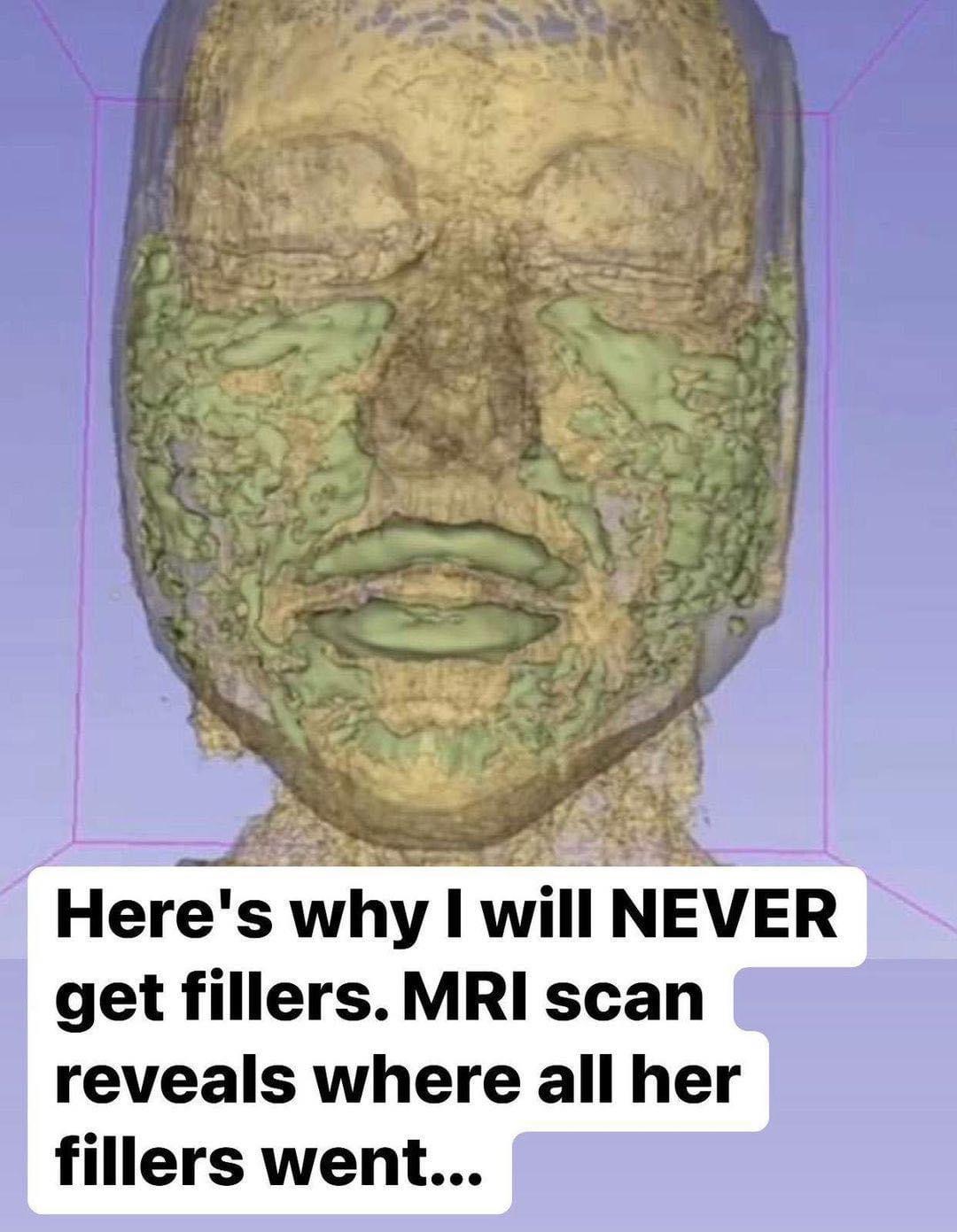 Doctor Reveals: MRI Scan Of The Face Of A 33-Year-Old Woman Reveals ...
